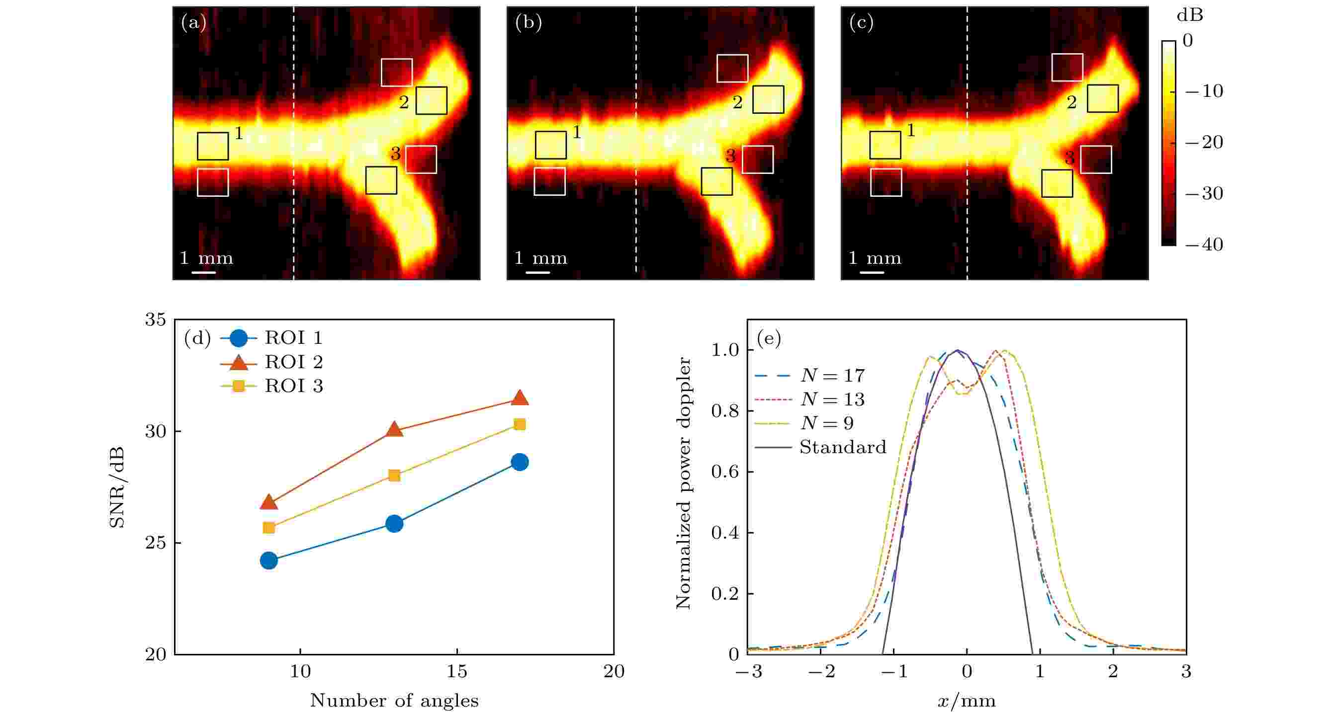 基于RCA阵列三维超快超声血流成像方法仿真研究